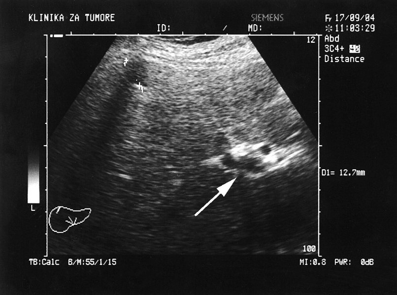 ultrazvuk - Hrvatska enciklopedija