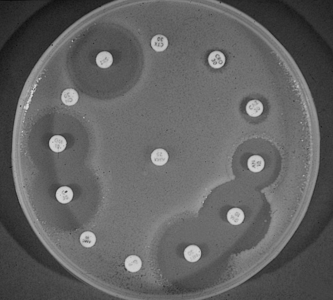 antibiogram - Hrvatska enciklopedija