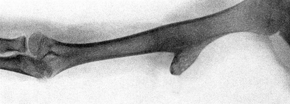 egzostoza - Hrvatska enciklopedija