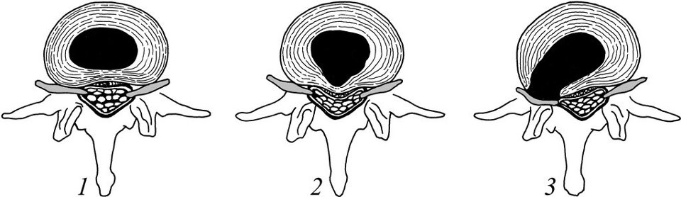 disk - Hrvatska enciklopedija