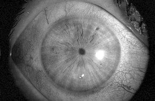 mioza - Hrvatska enciklopedija